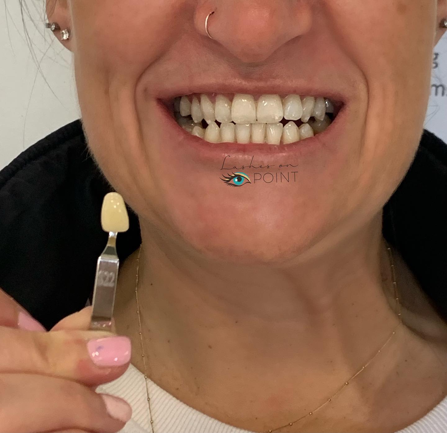 Cosmetic Teeth Whitening at Lashes On Point – Brighter Smiles in Just ...